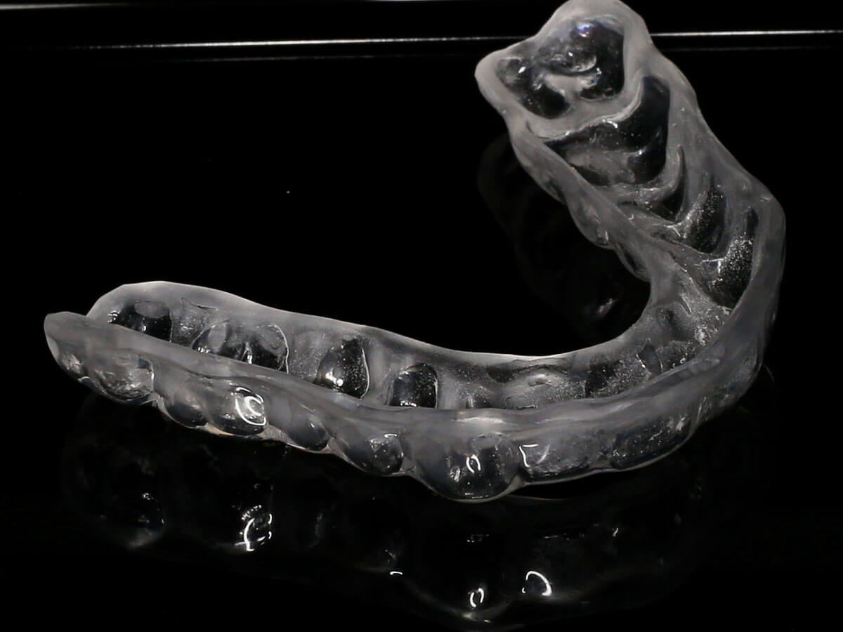Bruxism Splint - www.thepearls.gr